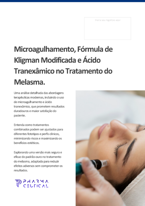 Tratamento do Melasma: Microagulhamento, Ácido Tranexâmico e Fórmula de ...